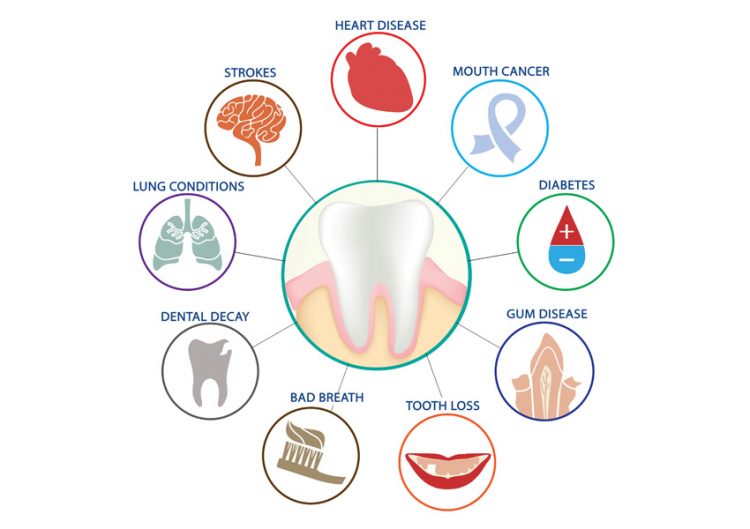 Oral Health Can Affect Your Health | St. Lawrence Dentistry